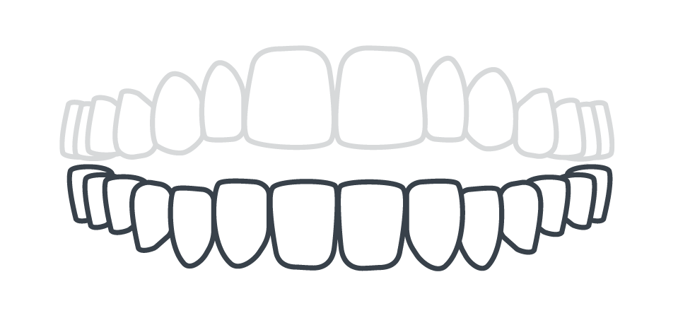 Request your free smile evaluation | Portman Smile Clinic